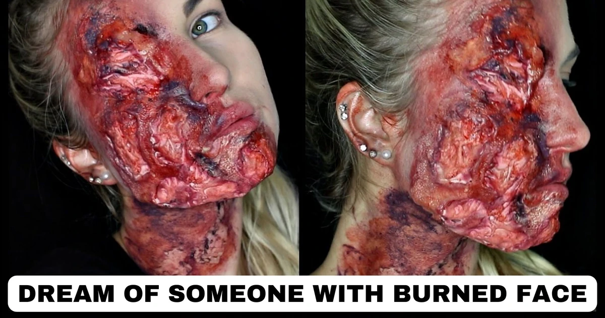 Have You Ever Experienced A Dream Of Someone With Burned Face?