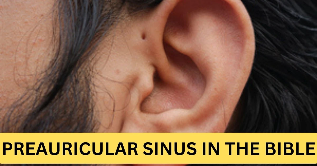 What Is The Significance Of Preauricular Sinus In The Bible?